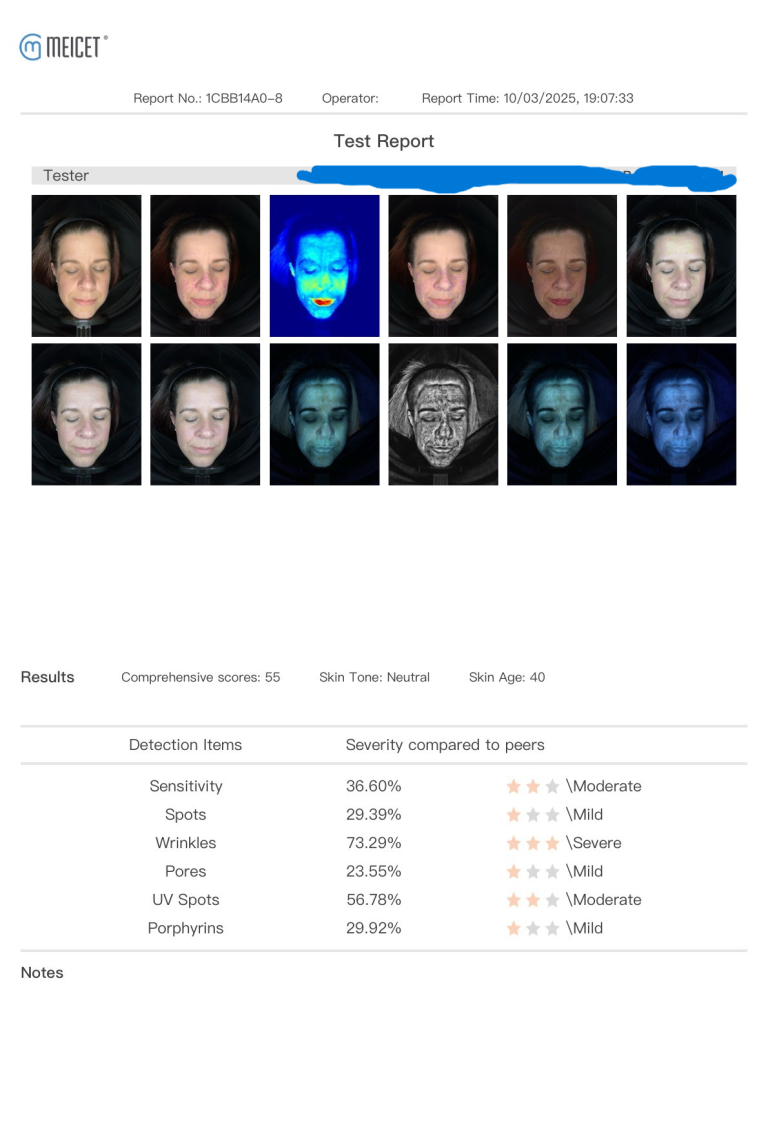 Skin Analysis - scientific data- an in-depth look at your skin | InSkin