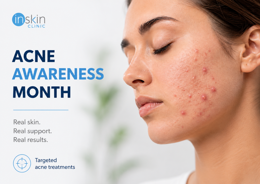 Acne Awareness Month | InSkin